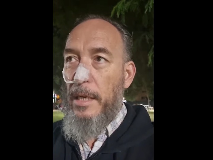 Oscar Osorio necesita ayuda económica para continuar su tratamiento ...